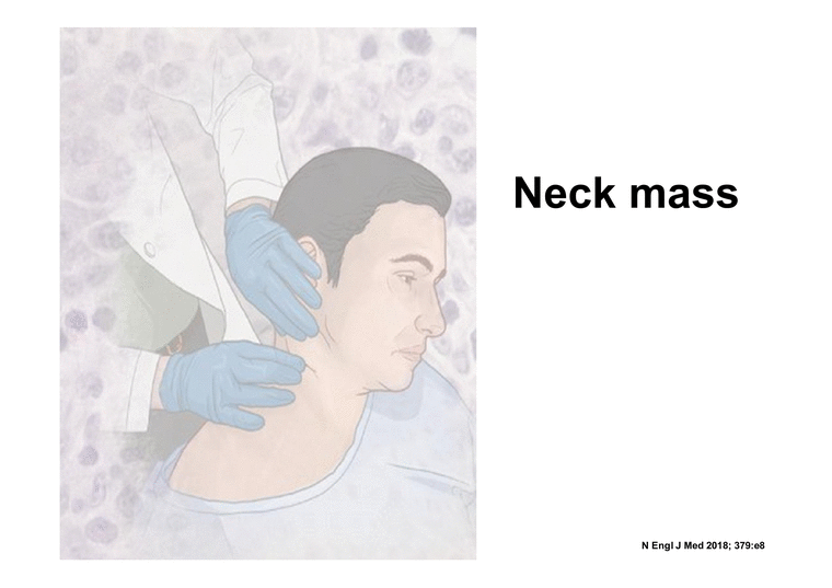 Neck mass_Clinical Practice Guideline Evaluation of the Neck Mass in ...