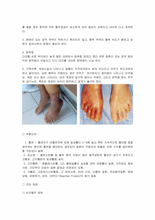 병태생리 PAOD - Peripheral arterial occlusive disease(말초 동맥 폐쇄성 질환) - 의약학