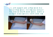 Medial Apophysitis (Little Leaguer s Elbow) - 의약학