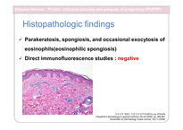 Pruritic urticarial papules and plaques of pregnancy (PUPPP) 피부과 대본있음 - 의약학